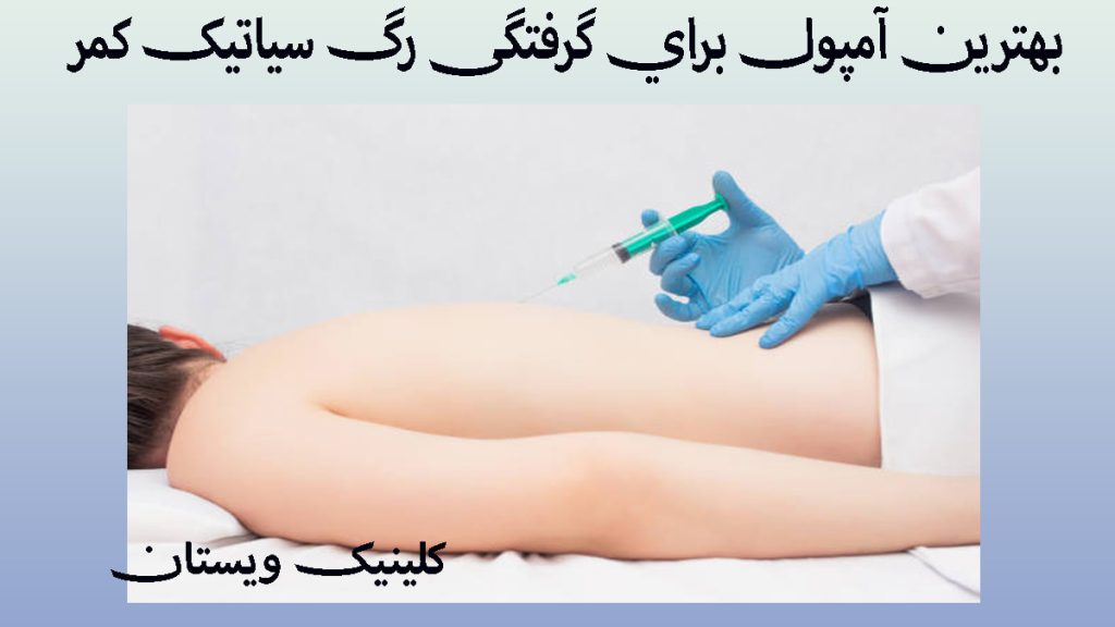 بهترین آمپول برای درد سیاتیک آمپول برای گرفتگی رگ سیاتیک کمر
