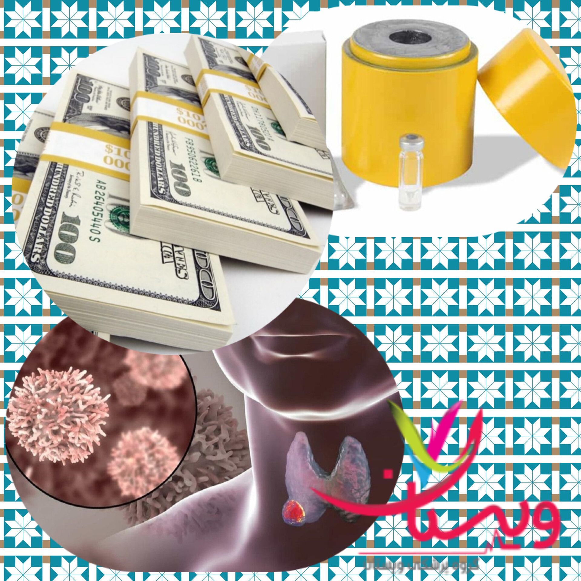 هزینه ید درمانی در سال 1404+2لیست هزینه ید درمانی تیروئید